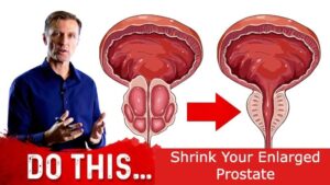 The Prostate Protocol Review: Does It Really Work?or SCAM